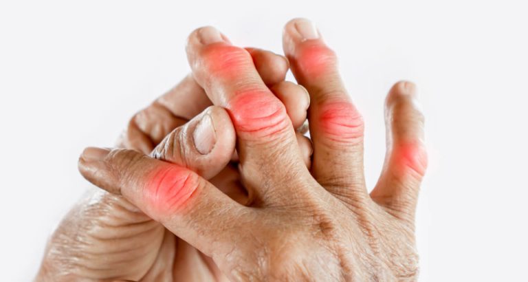Trigger Finger & Trigger Thumb - DR+ Medical & Paincare